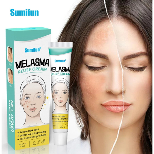 Effective Melasma Remover Cream Collagen Pekas Remover Dark Spot ...
