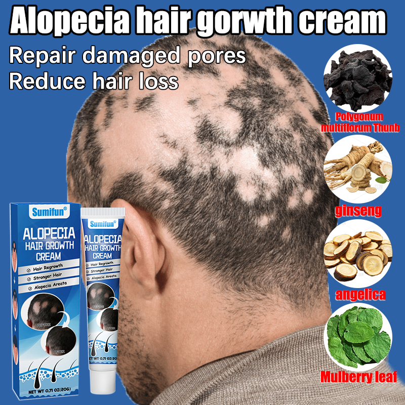 Baldness Cream Alopecia Hair Growth Cream 20g Dense Hair Beauty Hair ...