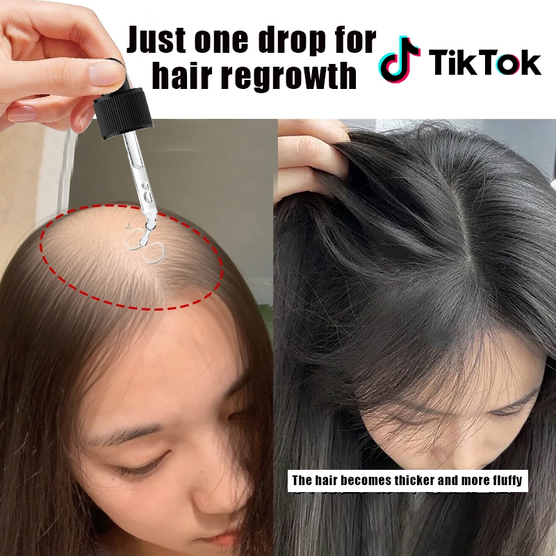 MAIGOOLE Anti Hair Loss & Promote Growth Serum, Refreshing NonSticky ...