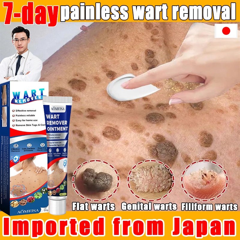 Recurring warts? Try natural wart removal methods! Helps filiform warts ...