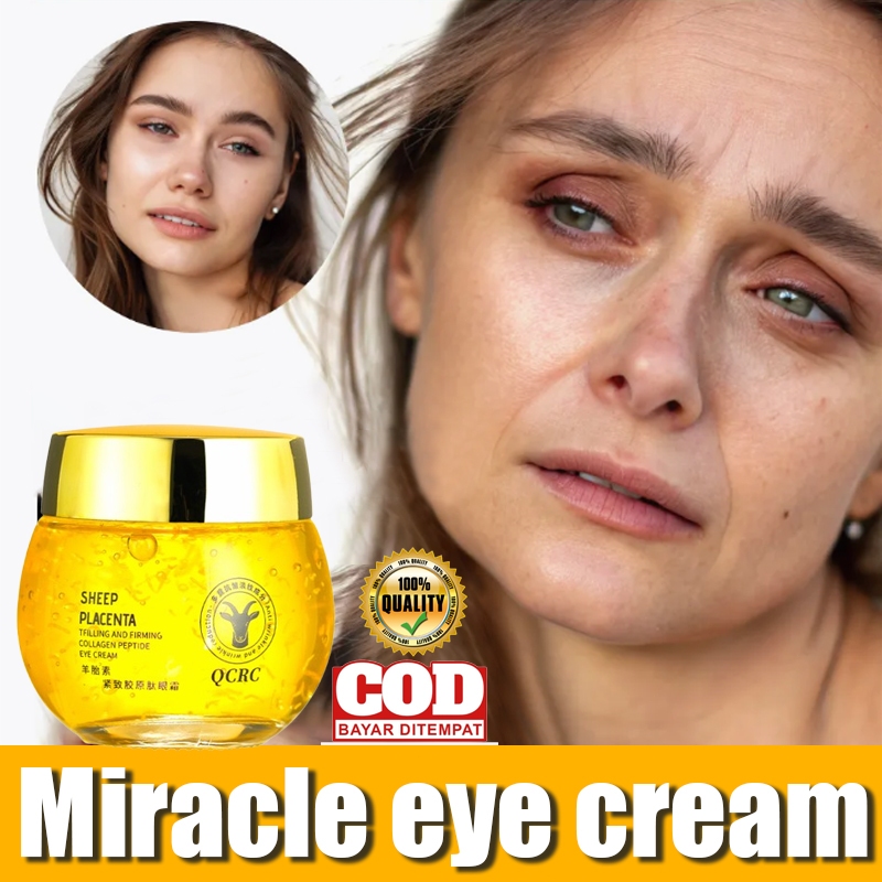 dark circles Eye cream Anti-Wrinkle Eye cream remove puffy eye fat ...