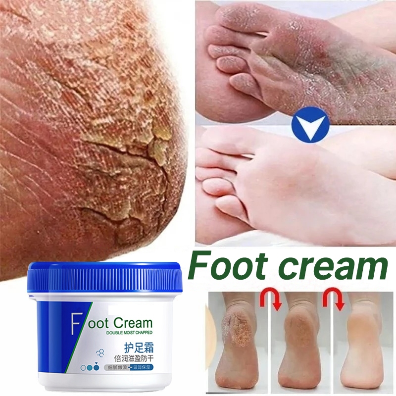 Vaseline Foot Cream/foot cream/Dry Hands Repair 50g Feet Exfoliate ...