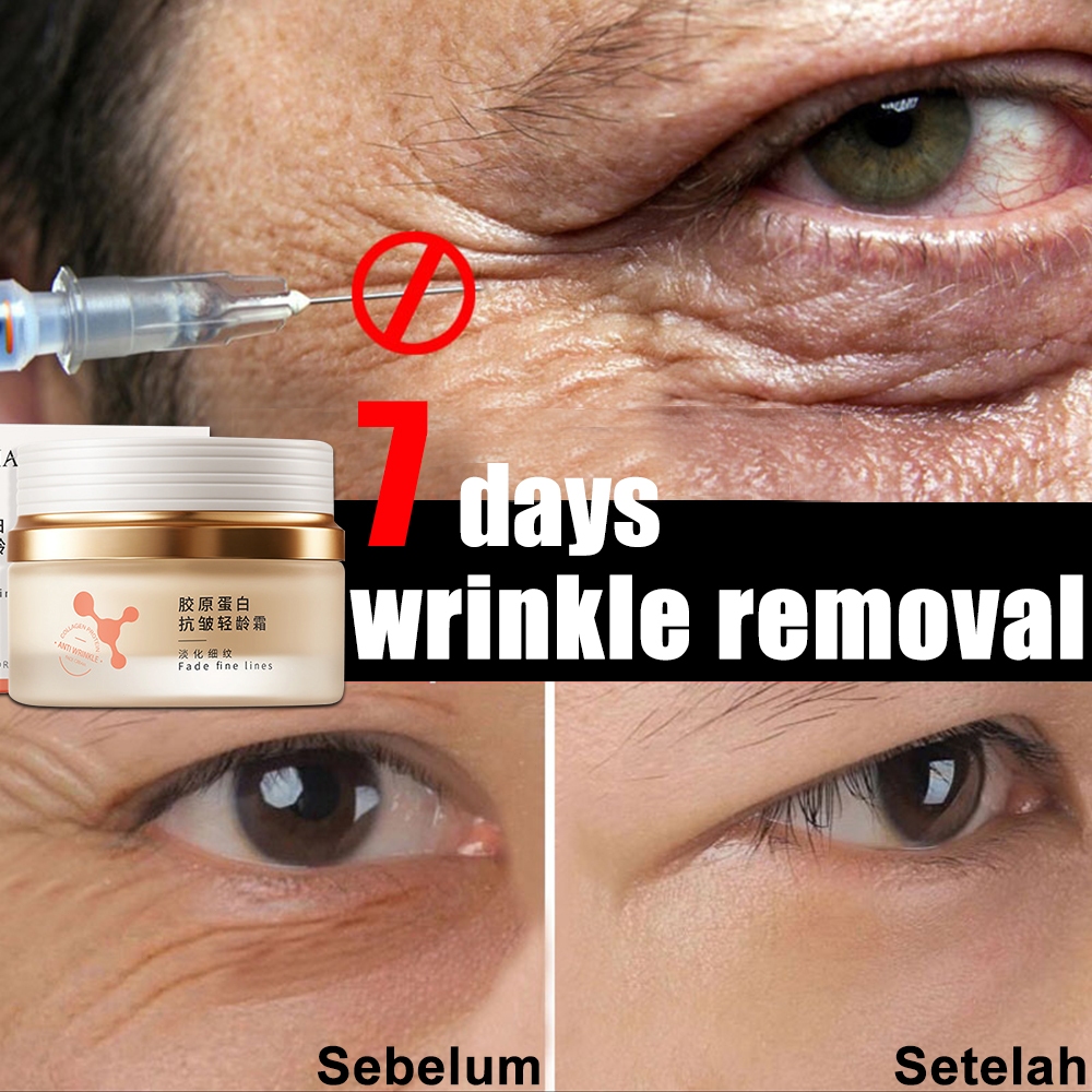 anti wrinkle cream Qingling Wrinkle Removal Cream retinol cream anti ...