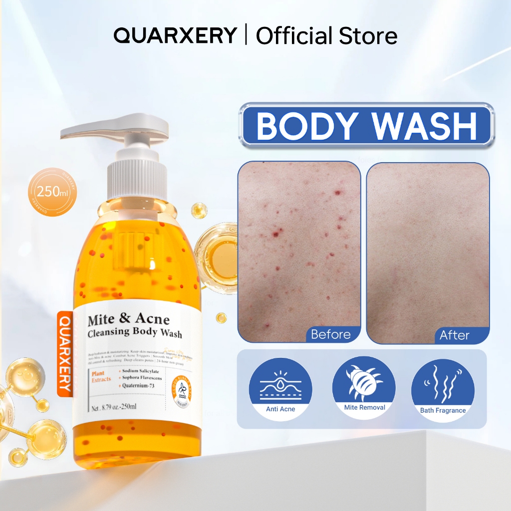 QUARXERY Mite & Acne Cleansing Body Wash Anti-Acne Body Shower ...