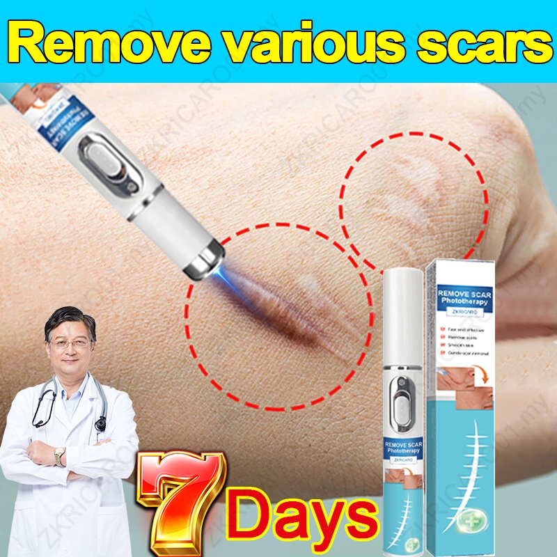 【Fast Scar Removal]】Laser scar treatment pen, effectively fades scars ...