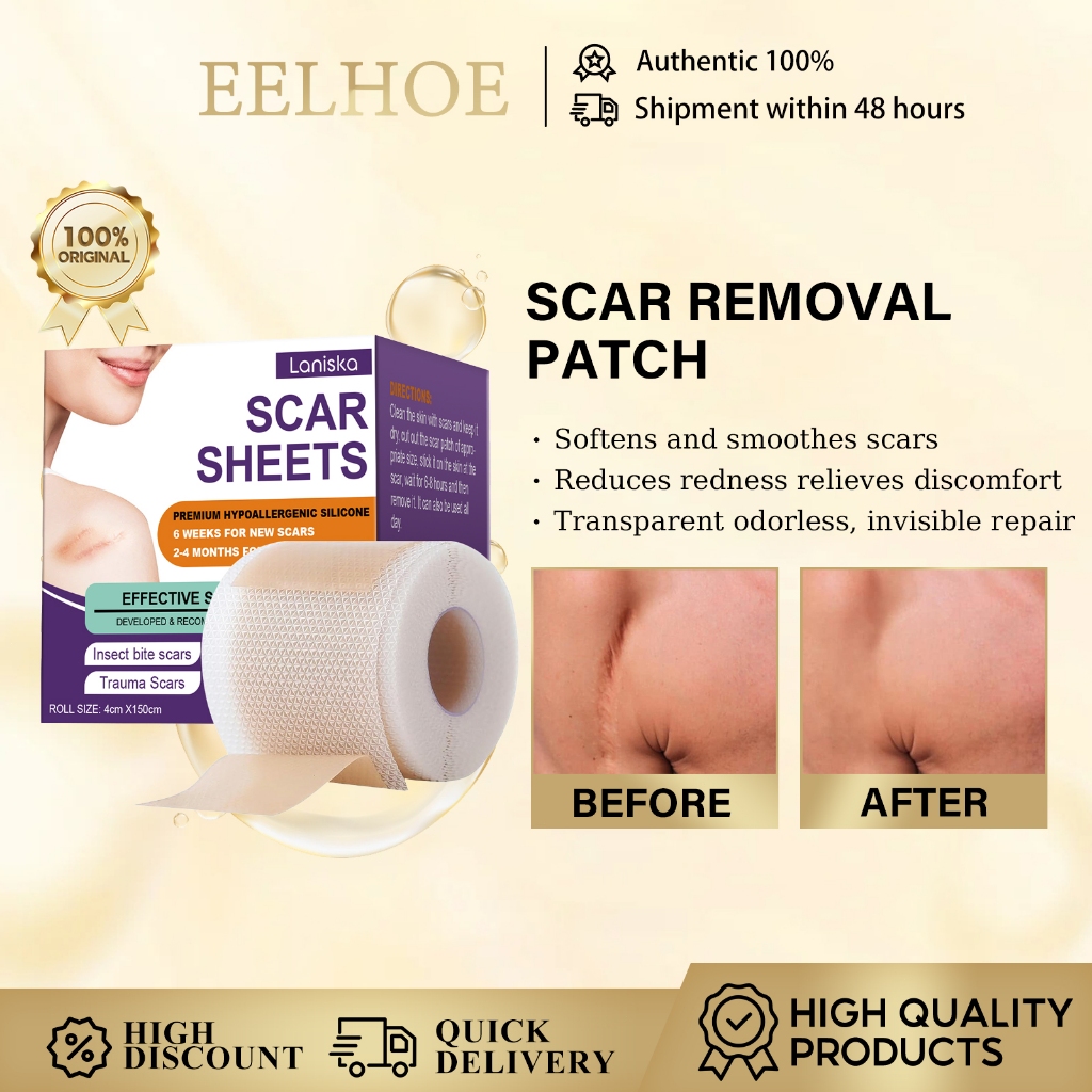 Scar Removal Patch Old Scar Remover Patch 4cm*150cm/Box for Removing ...