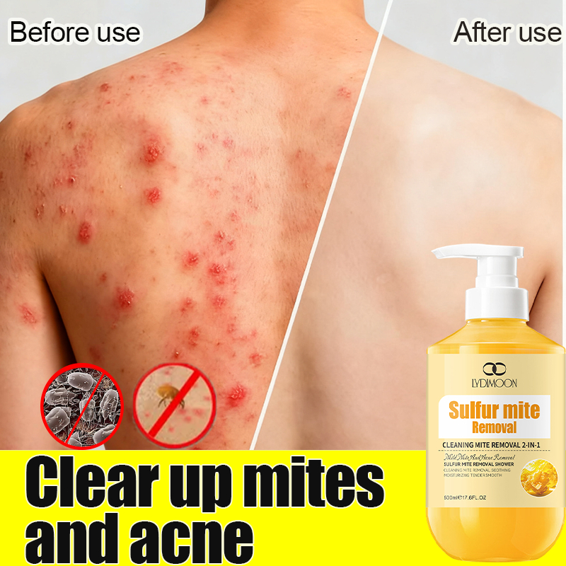 Shower gel, anti-mite shower gel 500ml, sulfur anti-mite shower gel ...