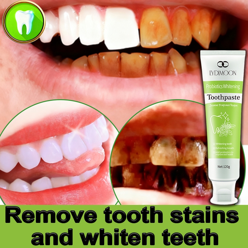 [LYDlMOON] Probiotic whitening toothpaste Whitens Teeth Probiotic ...