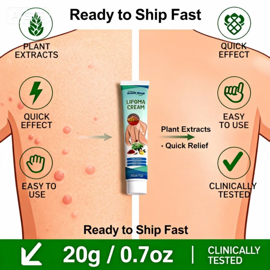 South Moon Lipoma Cream Original 20g Lipoma Lump Ointment Lump ...