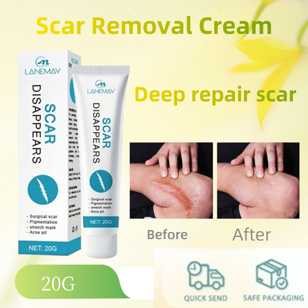 Scar removal cream, removes dark scars, removes scabies scars, leg ...