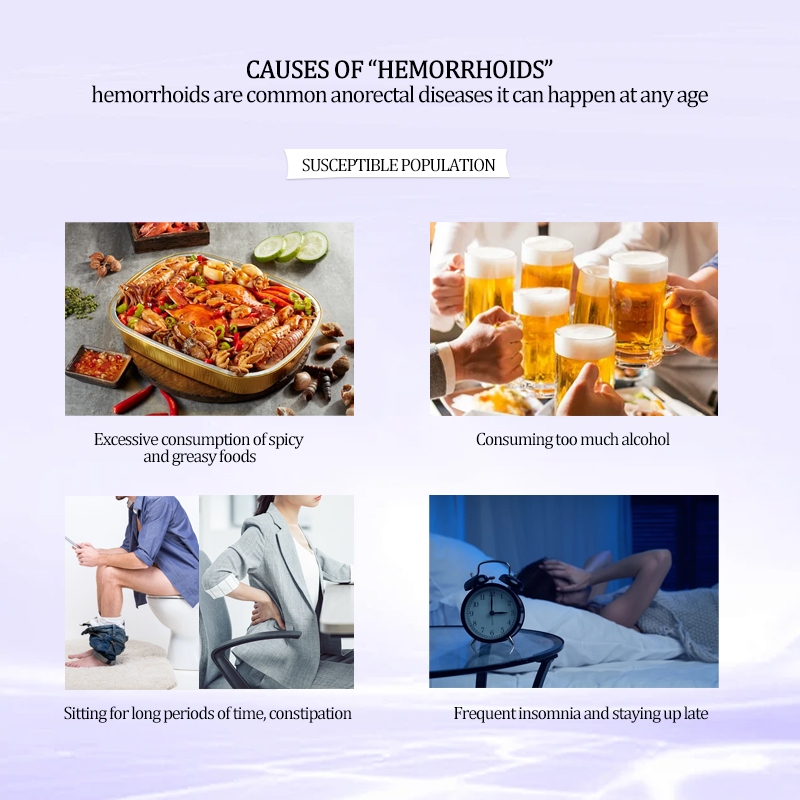 Hemorrhoids cream ubat buasir 痔疮膏 Herba Cina Krim Buasir Relieves ...