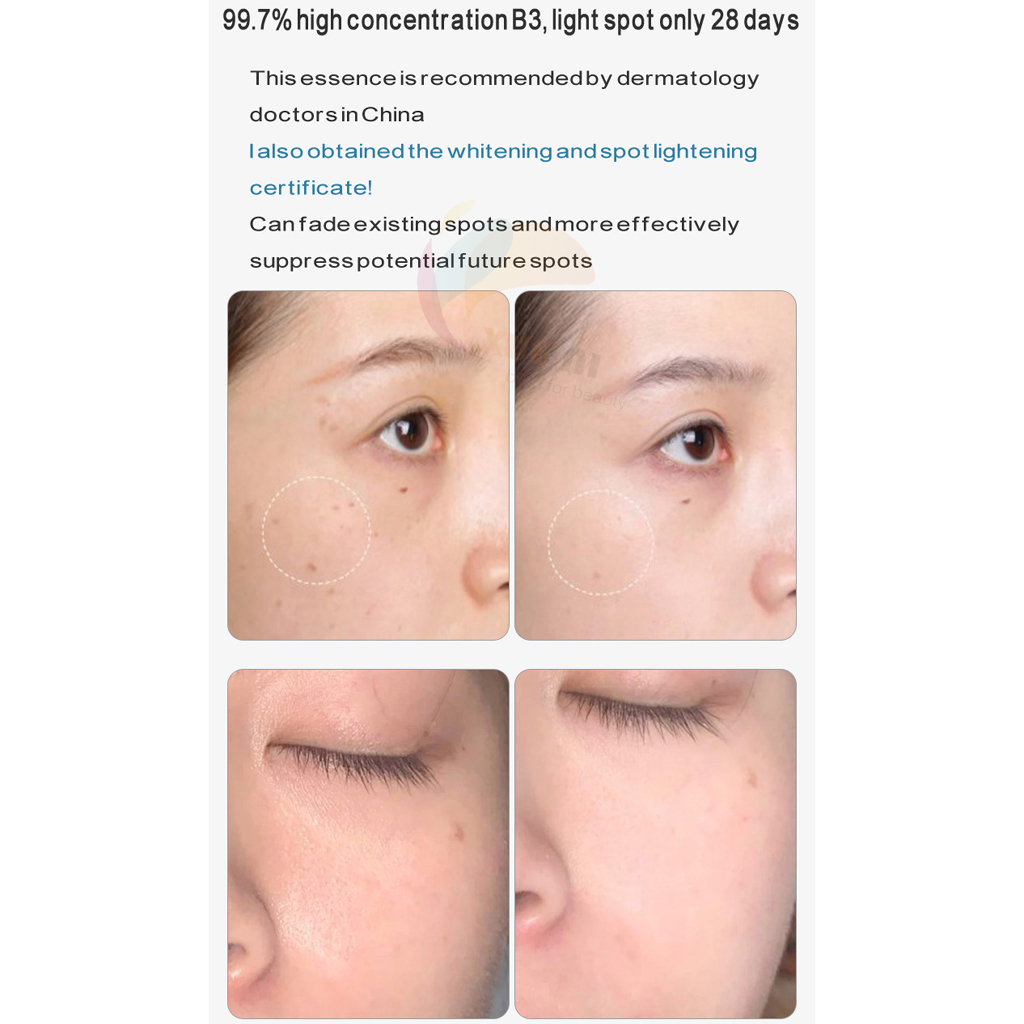 Official Authentic Olay Spot lightening bottle repair essence ...