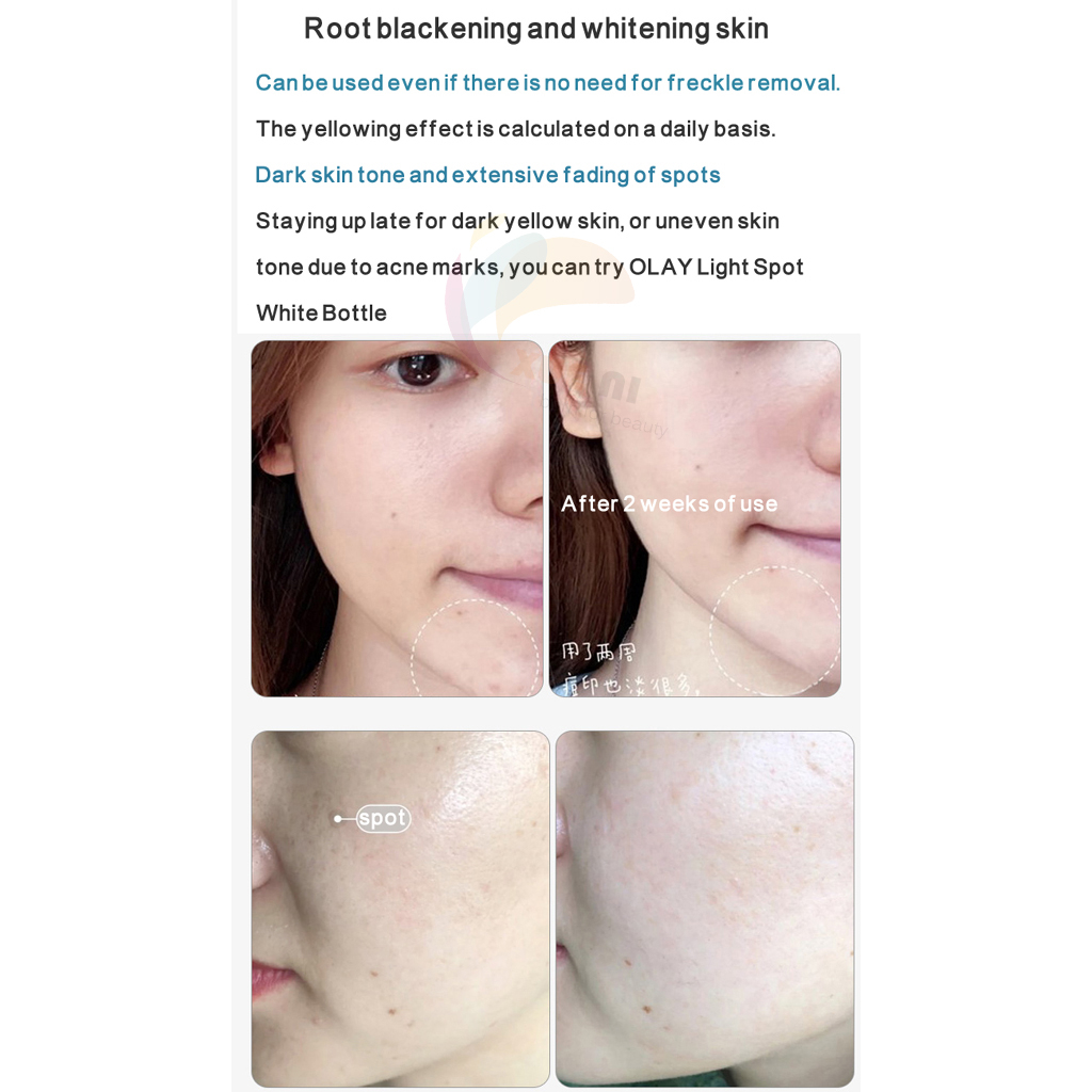 Official Authentic Olay Spot lightening bottle repair essence ...