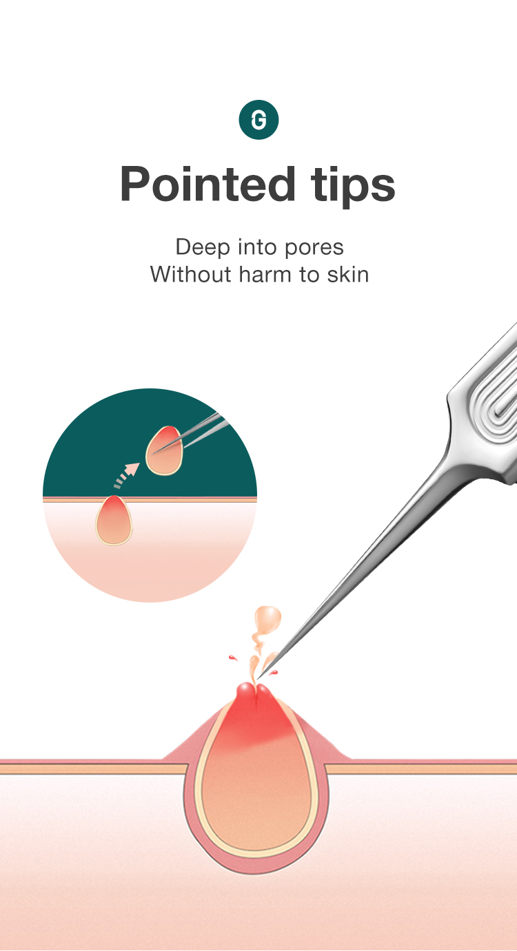 MR.GREEN Ingrown Hair Tweezers Needle Nose Pointed Tips Tweezers For ...