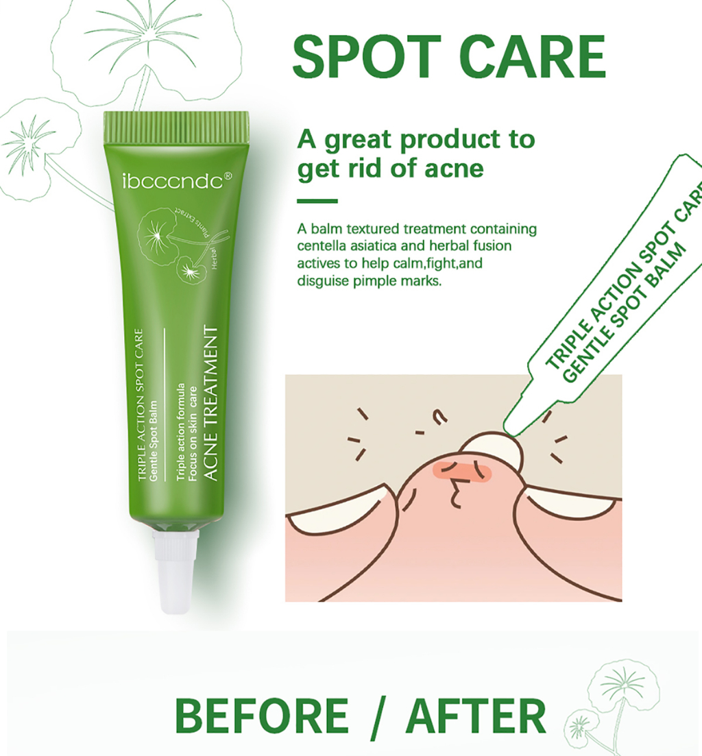 ibcccndc 15g*2 Acne Remover Cream Acne Plus Triple Action Spot Care ...