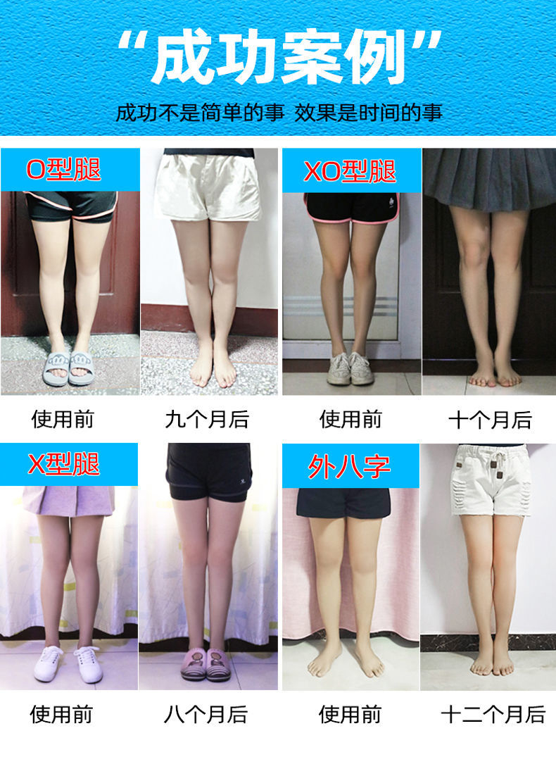 O-shaped leg correction insoles, leg-shaped straight leg arto型腿矫正鞋垫矫正腿型 ...