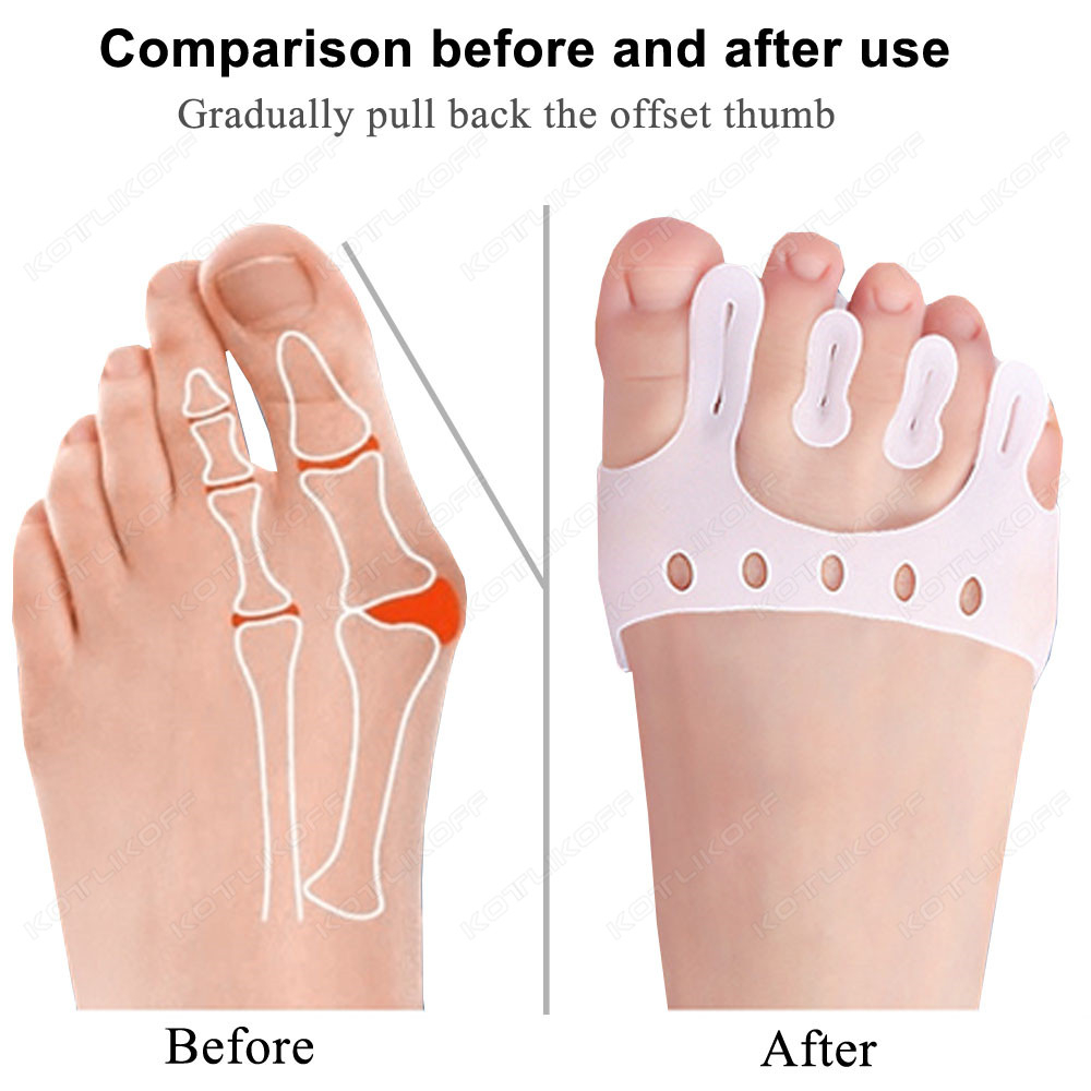 Five Toe Separator Hallux Valgus Corrector Thickened Forefoot Cushion ...