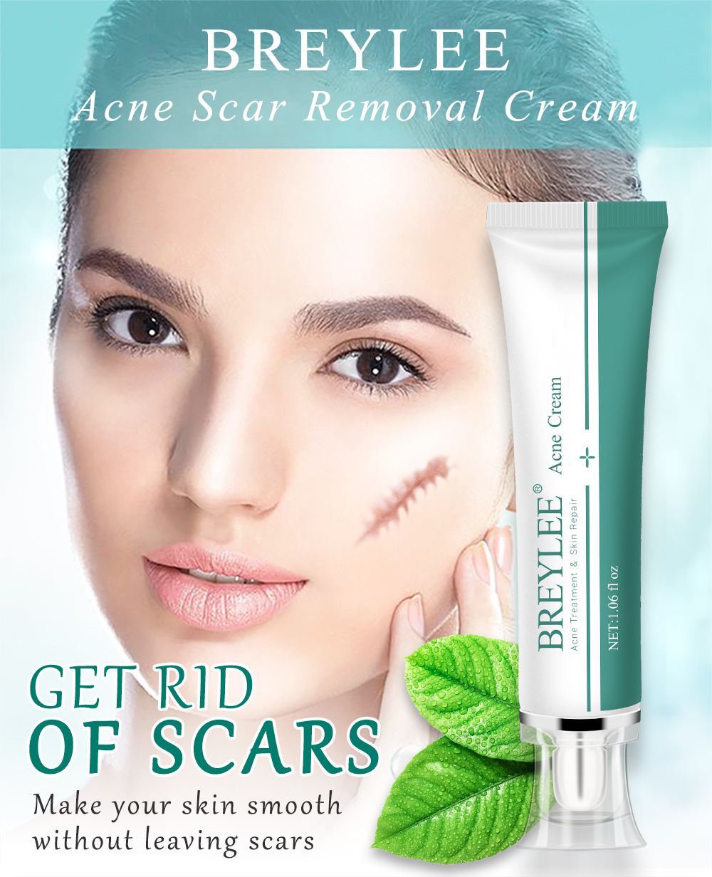 BREYLEE Acne Scar Removal Cream Fades Acne Marks Fade Scar Melanin ...