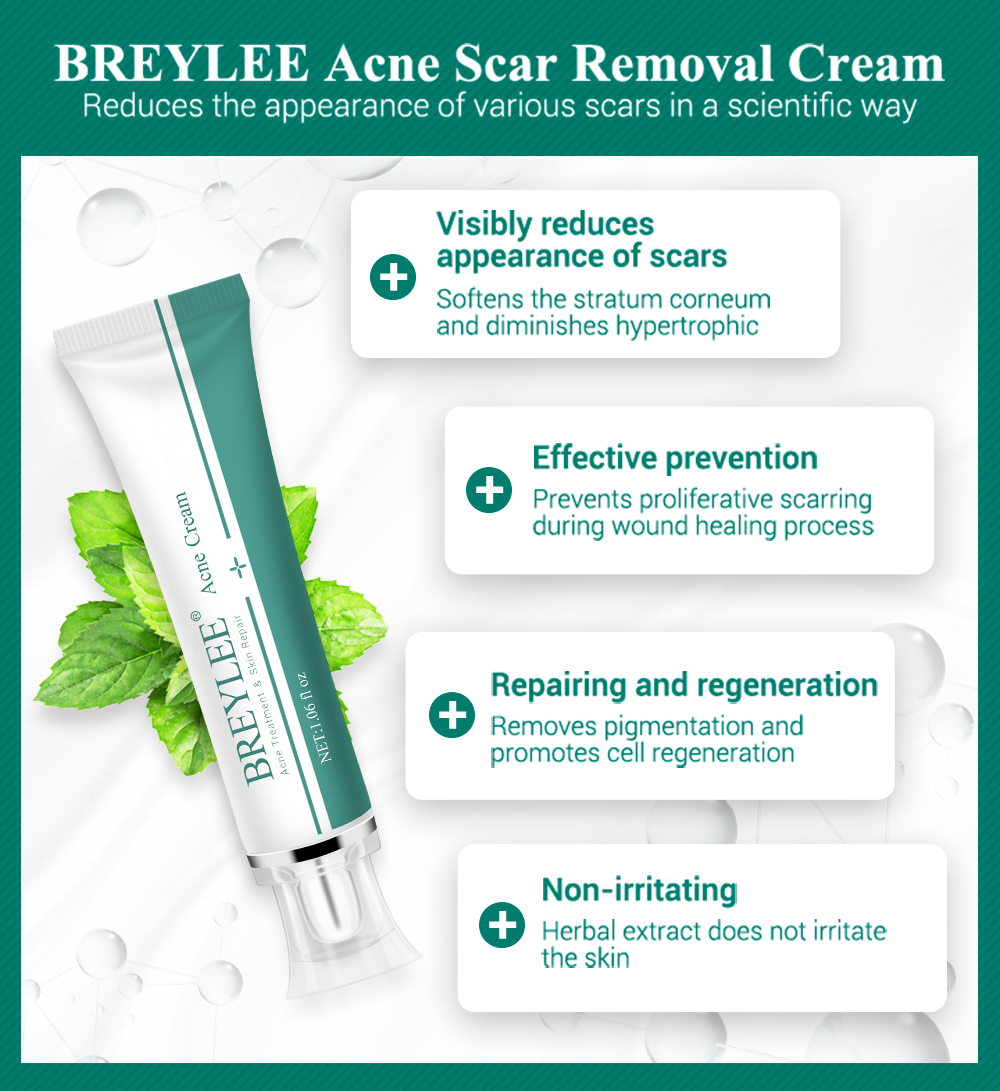 BREYLEE Acne Scar Removal Cream Fades Acne Marks Fade Scar Melanin ...