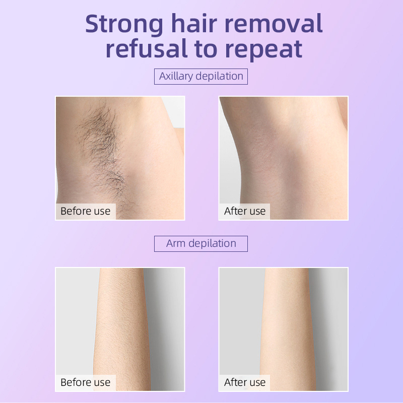 IPL Laser Epilator hair removal device Laser Hair Removal Device 500000 ...
