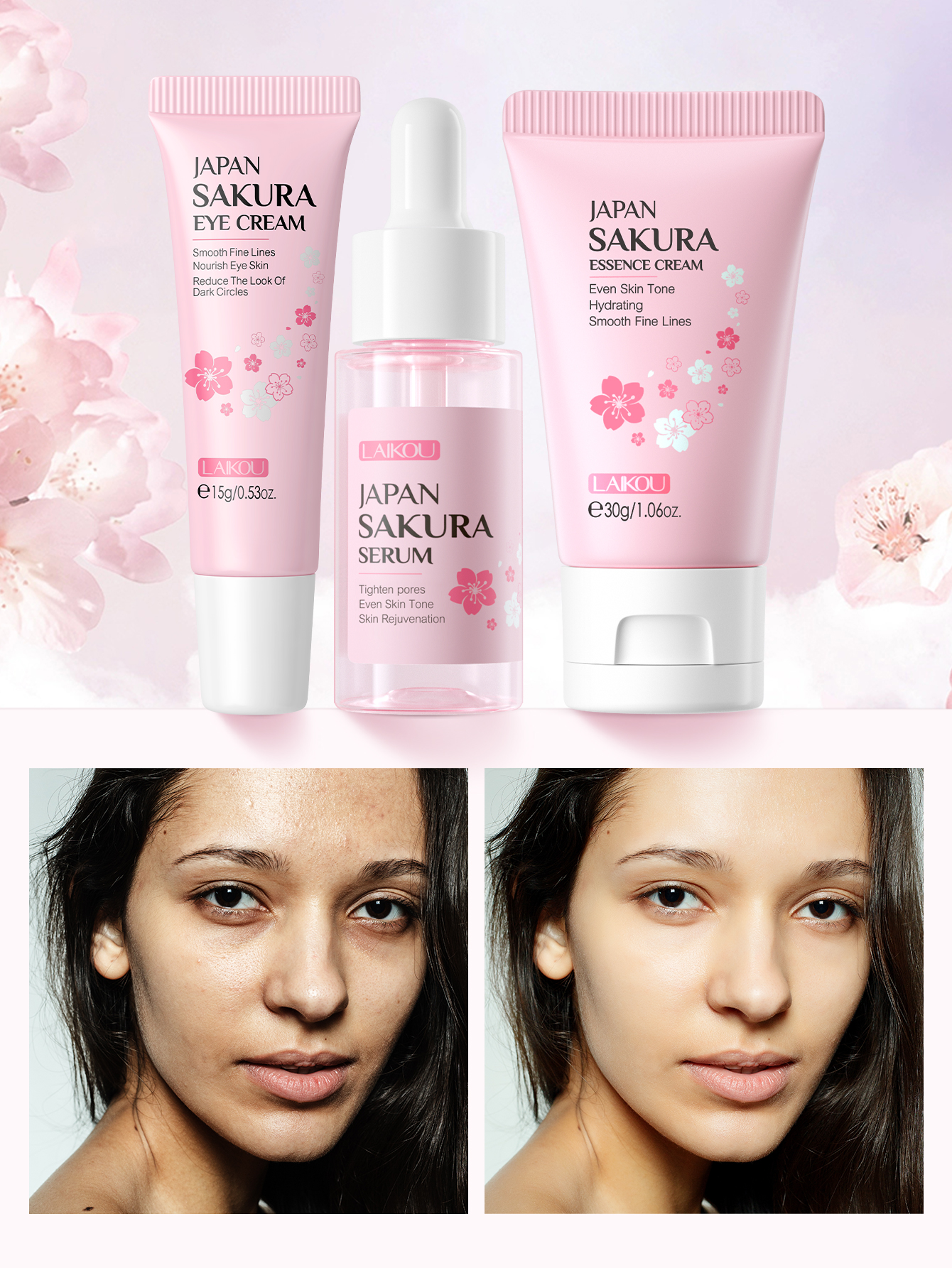 LAIKOU Sakura Skin Care Facial Serum Lighten Blemishes Cream Tighten ...