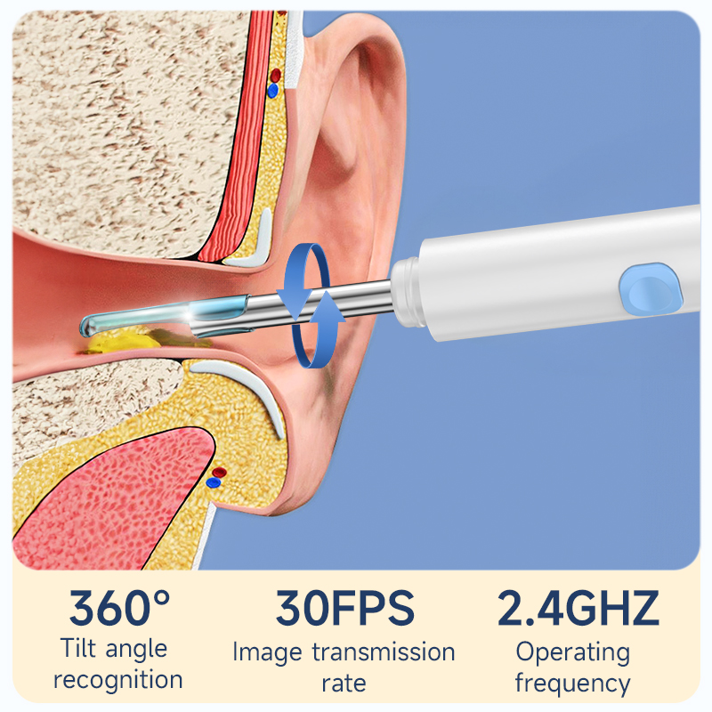 CylRedbat Earpick Smart Visual Camera Ear Scoop Ear Cleaner For Baby ...