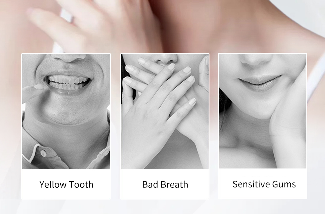RtopR Teeth Whitening Plaque Remover Teeth Cleansing Removes Stains ...