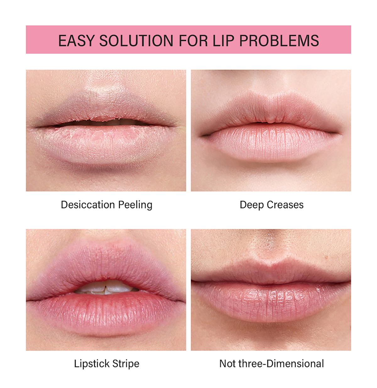 Lakerain Peptide Lip Treatment Moisturizing Lip Mask Gel To Remove Dead ...