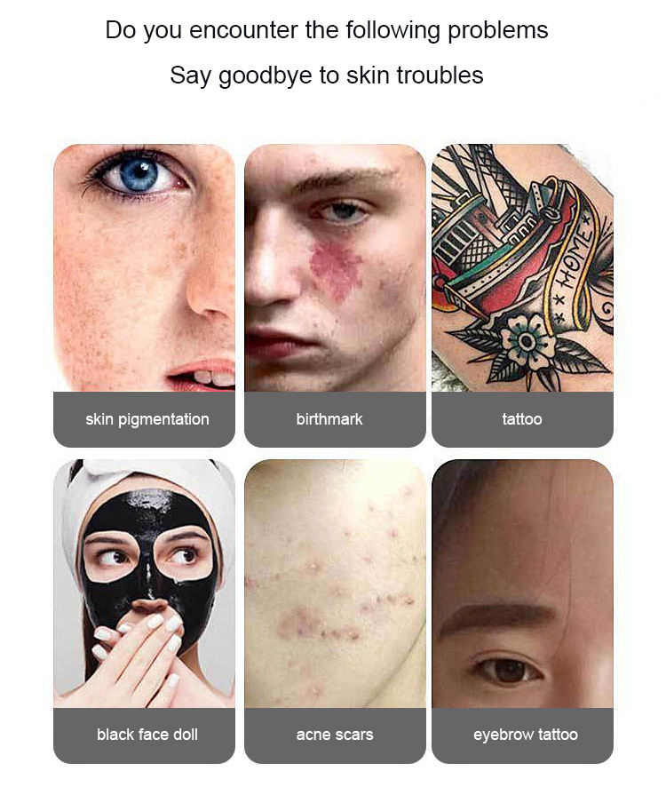 Picosecond laser pico laser Fine lineremoval Pigment removal Tattoo ...