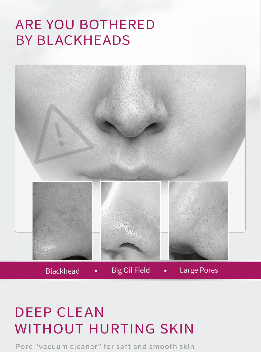 RtopR Mango Blackhead Remover Mask Deep Cleans Pores Shrink Pores ...