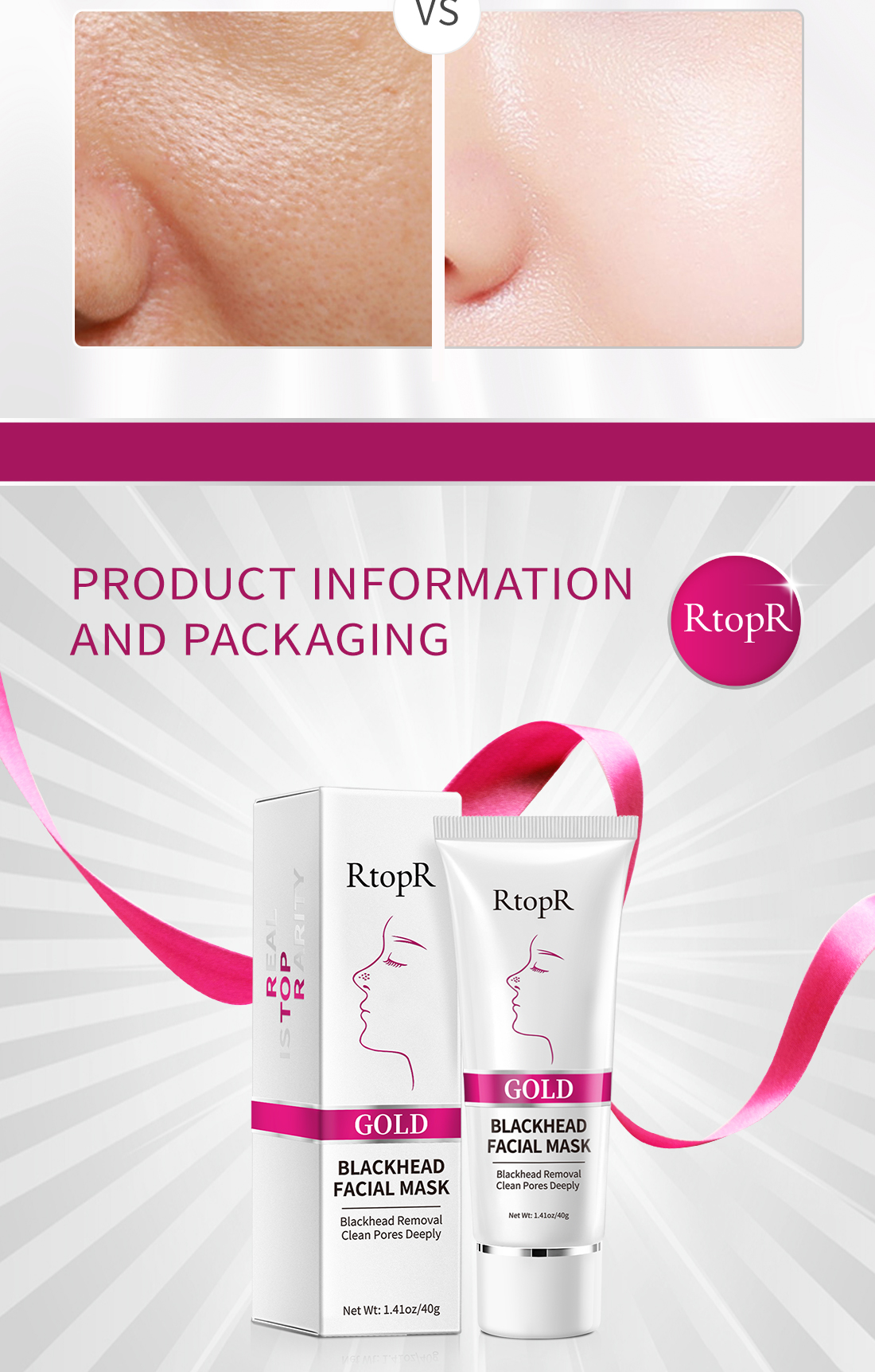 RtopR Gold Blackhead Removal Mask Treats Blackheads and Whiteheads Pore ...