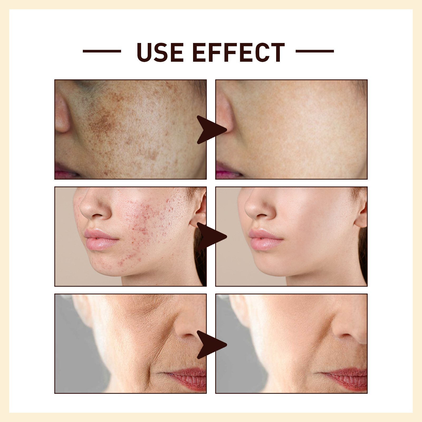 White Rice Serum Original Whitening Face Moisturizing Cream Anti ...