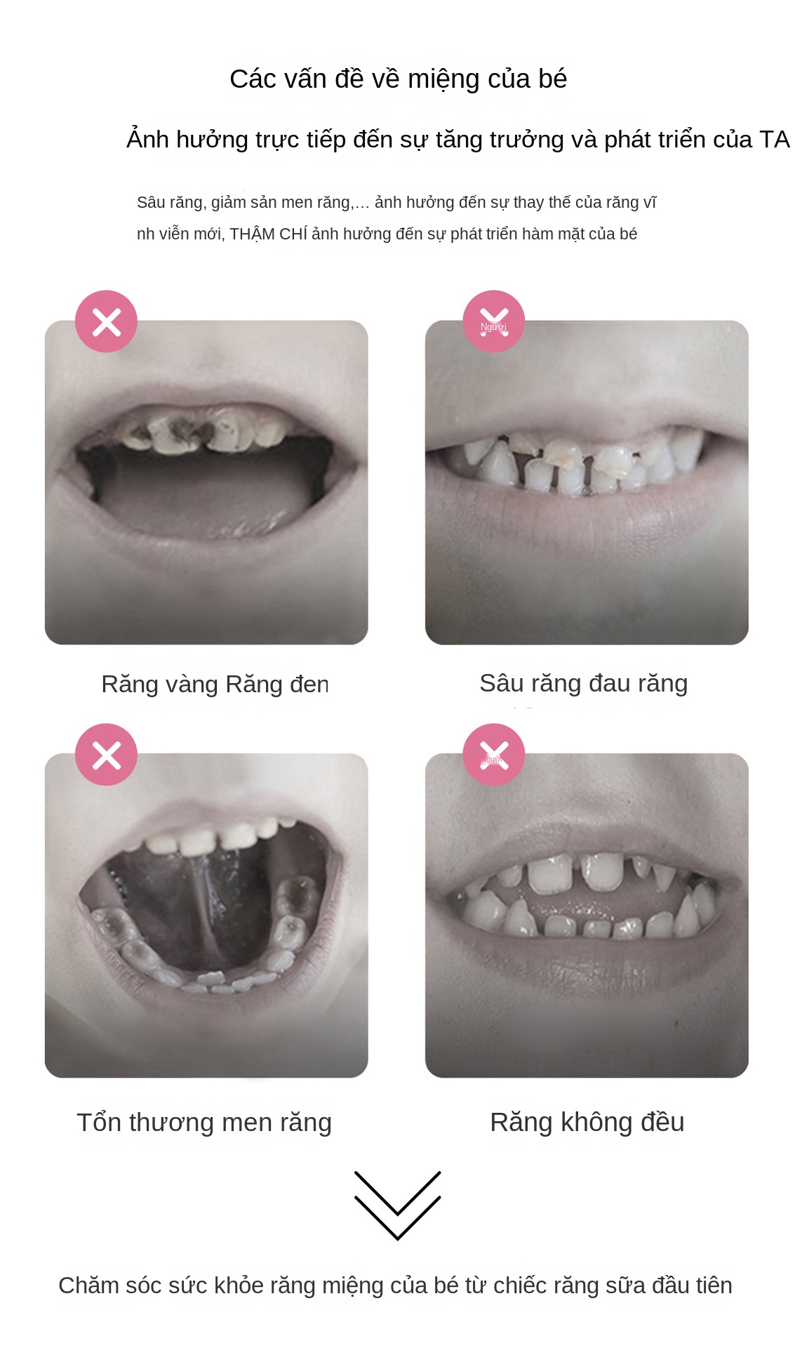 Sevich Baby Ora Fluor Children's Toothpaste Low Fluoride Anti Cavity ...