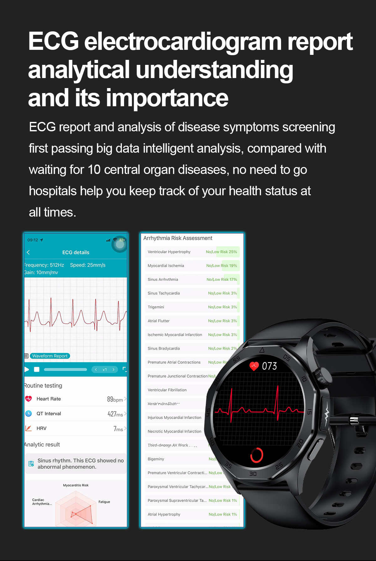 Medical Grade Smart Watch Blood Sugar Blood Lipid Uric Acid ECG+PPG ...