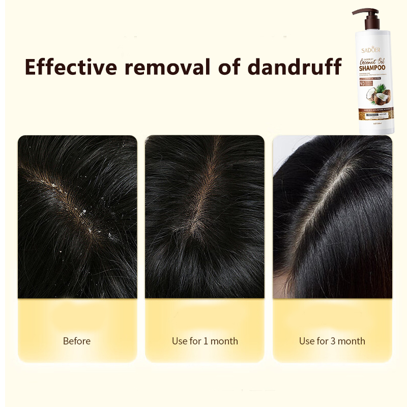 HB Original Anti-dandruff Shampoo Coconut Oil Shampoo kelemumur ubat Oil Control Relieve Scalp ...