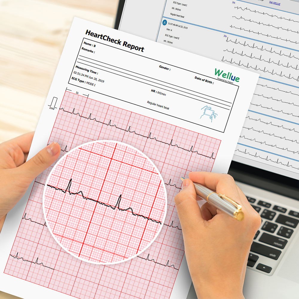 Viatom Wellue Checkme HeartMate handheld ECG monitor Professional Holter Recorder with AI-ECG ...