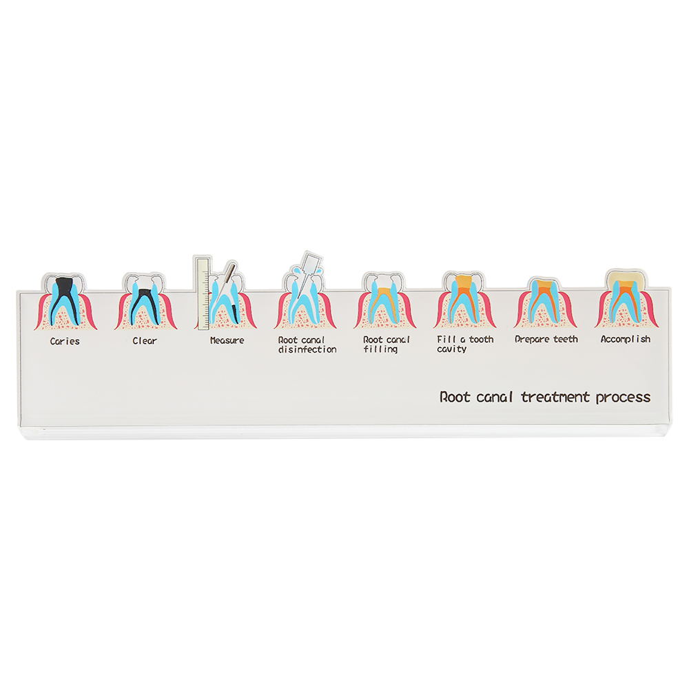 Dental Root Canal Treatment Flowchart Stand for Dental Laboratories ...