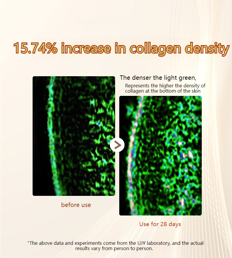 【Brand authorized】JUJY Multi-pole Radio-Frequency Eye Beauty Device Eye ...