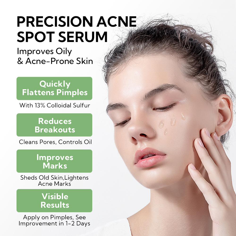LANBENA Acne Essence Salicylic Acid Anti-acne Serum Lighten Acne Scars ...