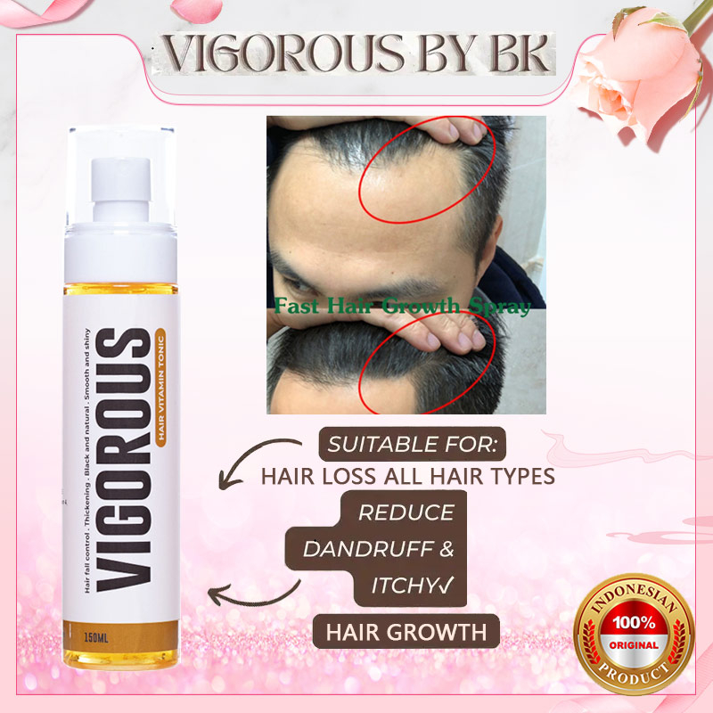 ORIGINAL VIGOROUS HAIR TONIC, SERUM & TREATMENT OIL BY BELLA KHAN (PEK ...