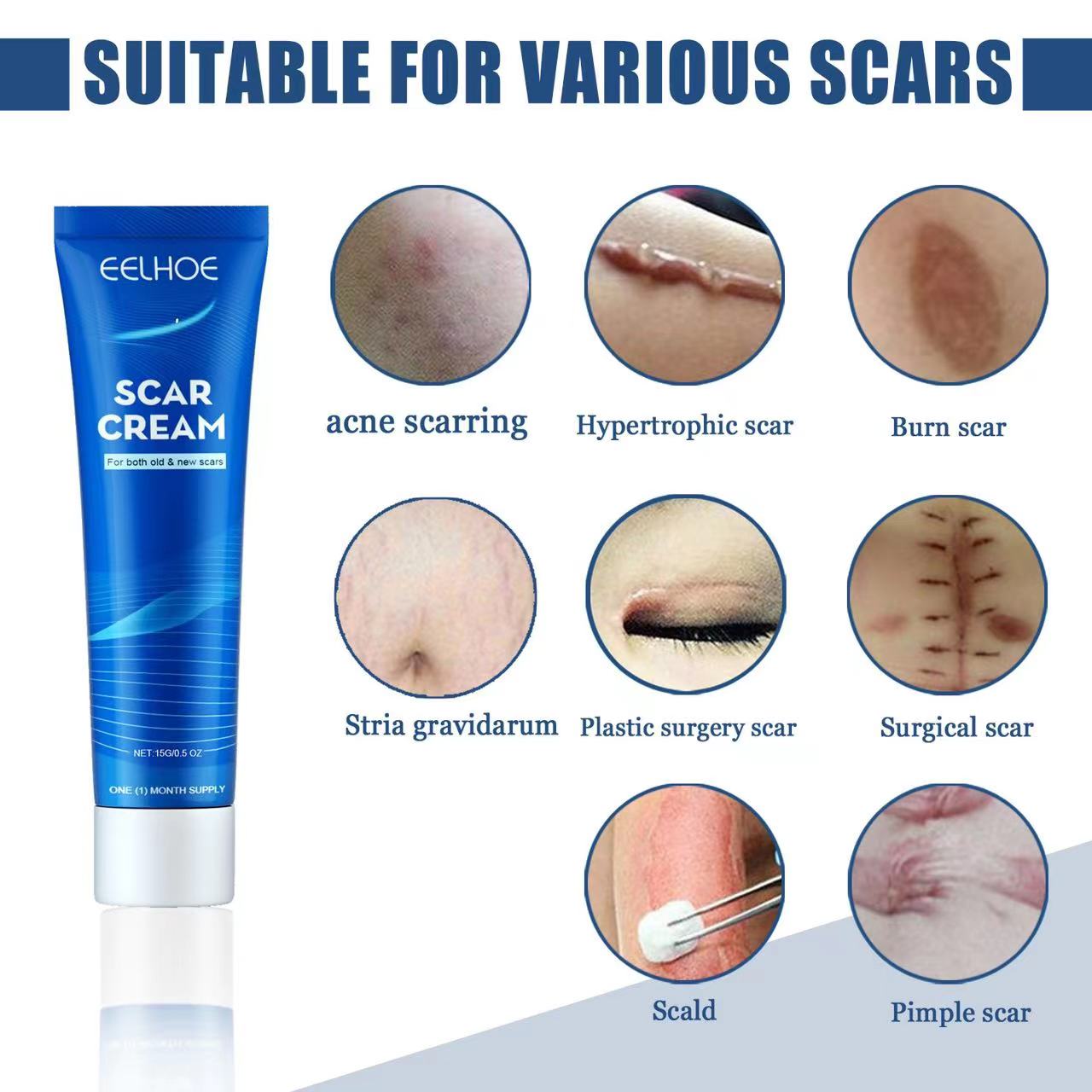 【Buy 2 get 1 free】EELHOE Scar Removal Cream Repair Old Scars Krim ...