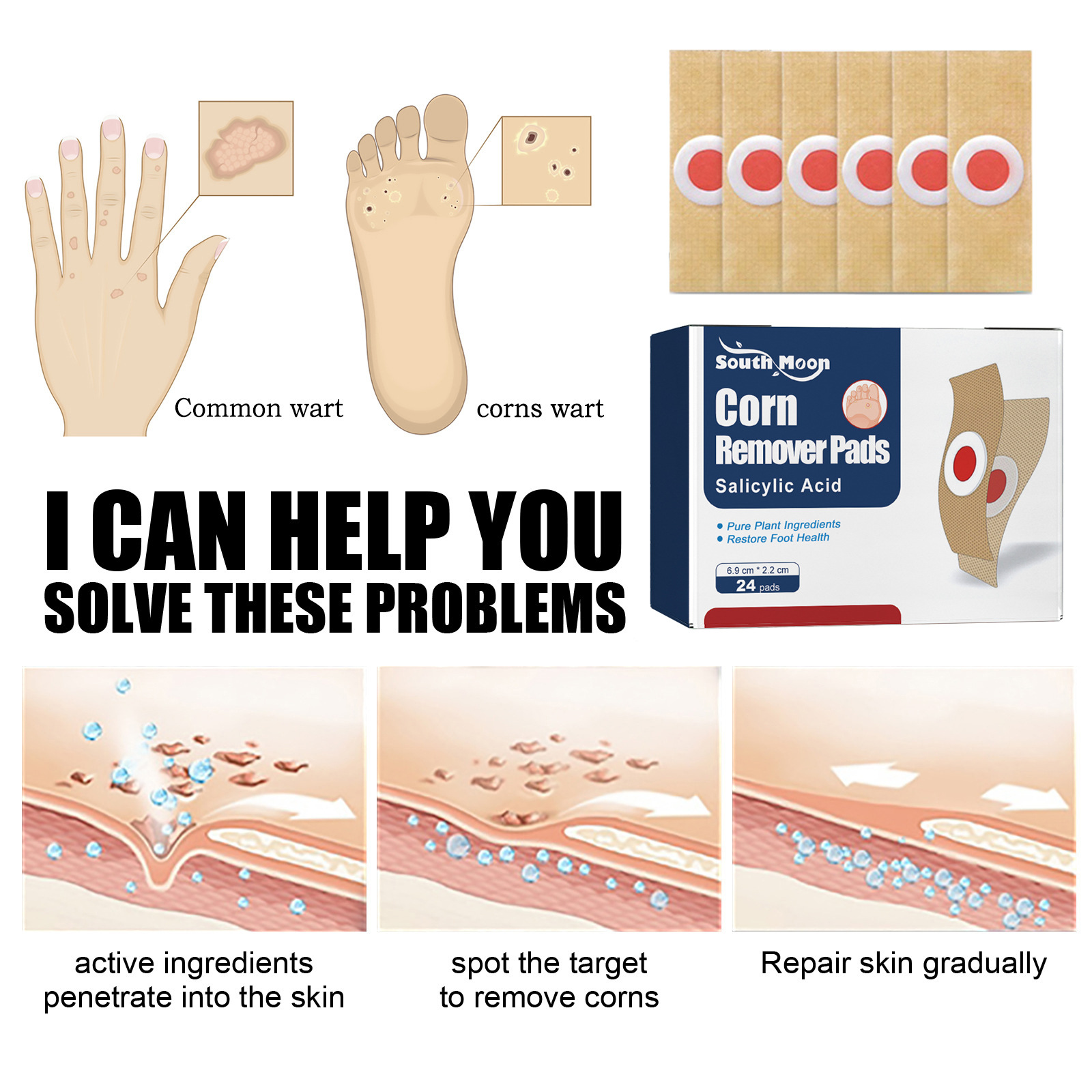 South Moon Medicated Wart Corn Remover - 24 Patches for Hand Foot ...