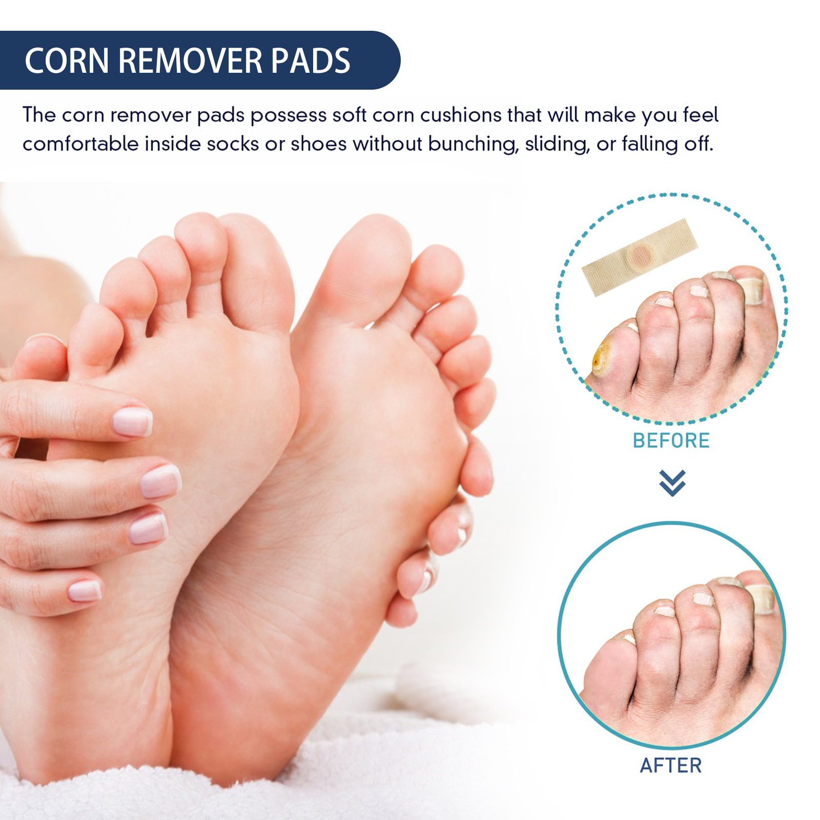 South Moon Medicated Wart Corn Remover - 24 Patches for Hand Foot ...