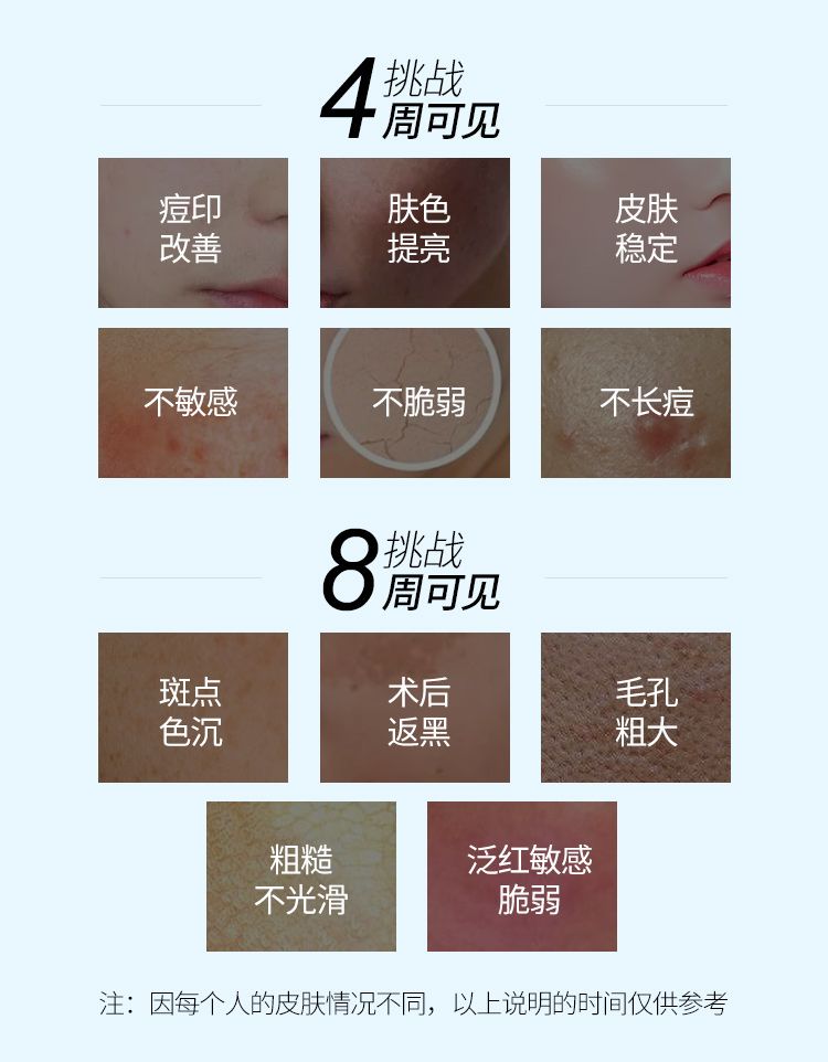 uface艺霏虾青素优斐斯传明酸精华液Yifei Astaxanthin Youpeis Tranexamic Acid Essence ...