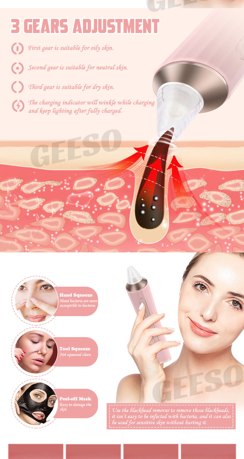 GEESO Electric Blackhead Removal With 3 Level Suction 4 Care Heads Pore ...