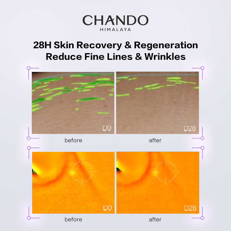 CHANDO Himalaya Rejuvenation Repairing Essence | Shopee Malaysia