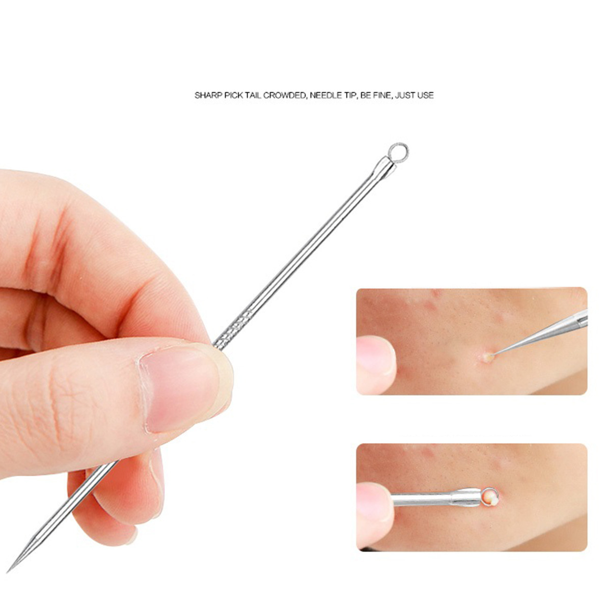 Ultimate 4-Pc Stainless Steel Blackhead Removal Set: Deep Cleansing For ...