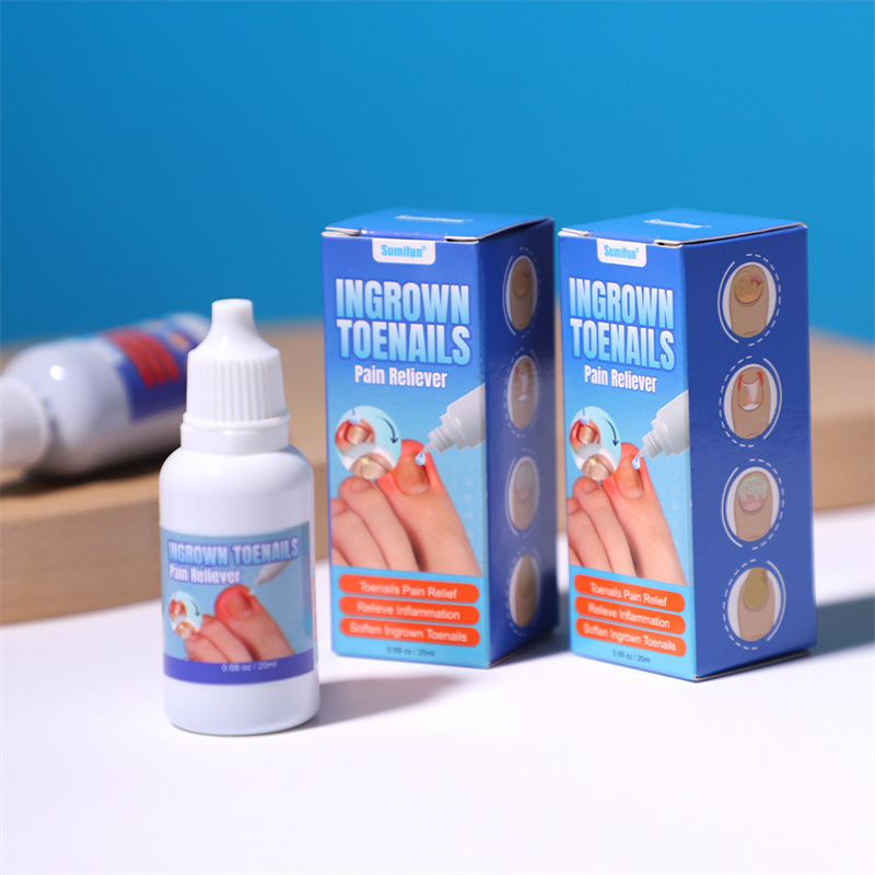 Terrific Numbing Cream For Ingrown Toenail Pictures