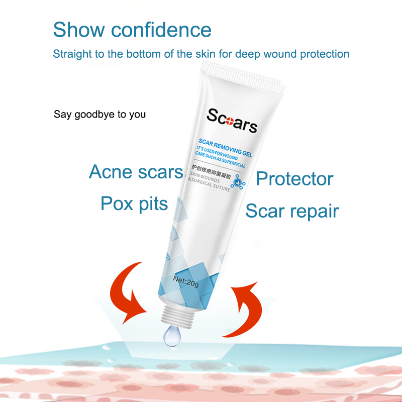 Scar Repair Gel Scars Treatment Gel Scar removal 20g Skin Mark Care ...