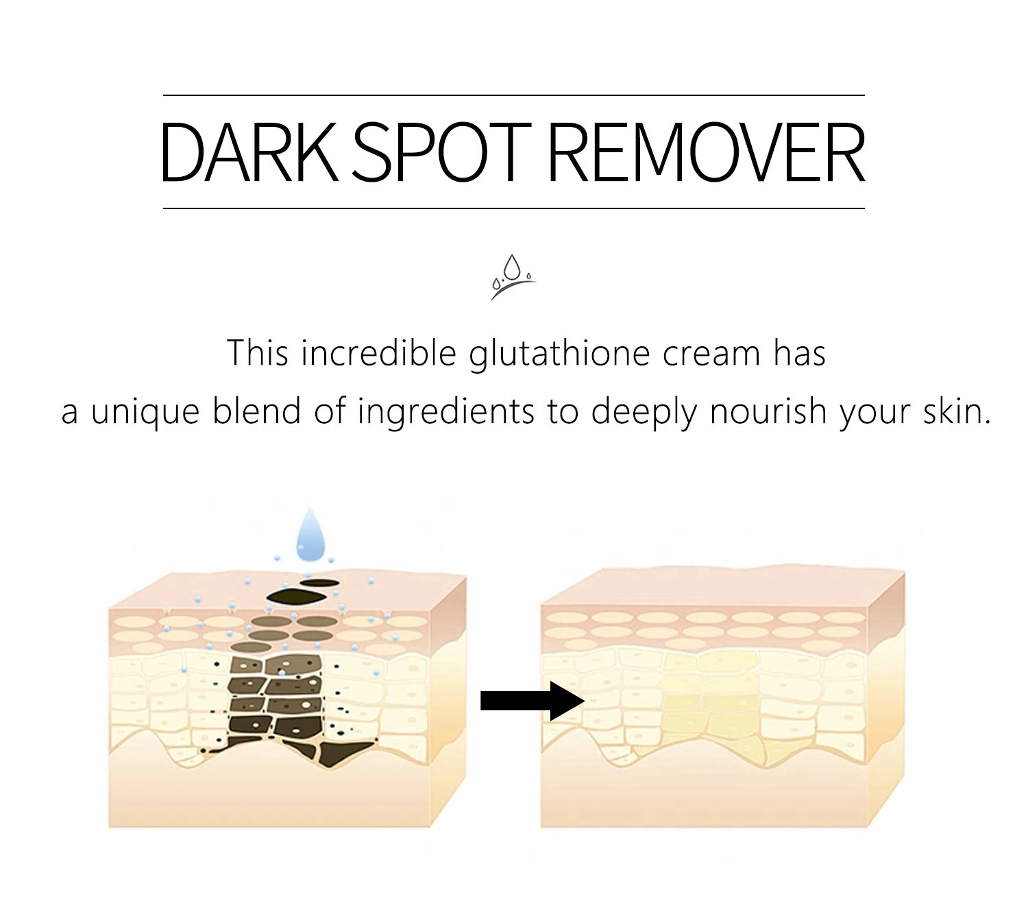 pigmentation remove cream 20g Glutathione Freckle cream Remove Melasma ...